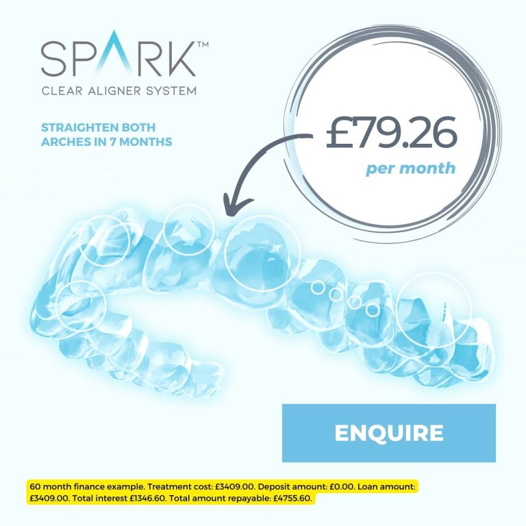 Spark Aligners | Cheaper & Better than Invisalign? Find Out