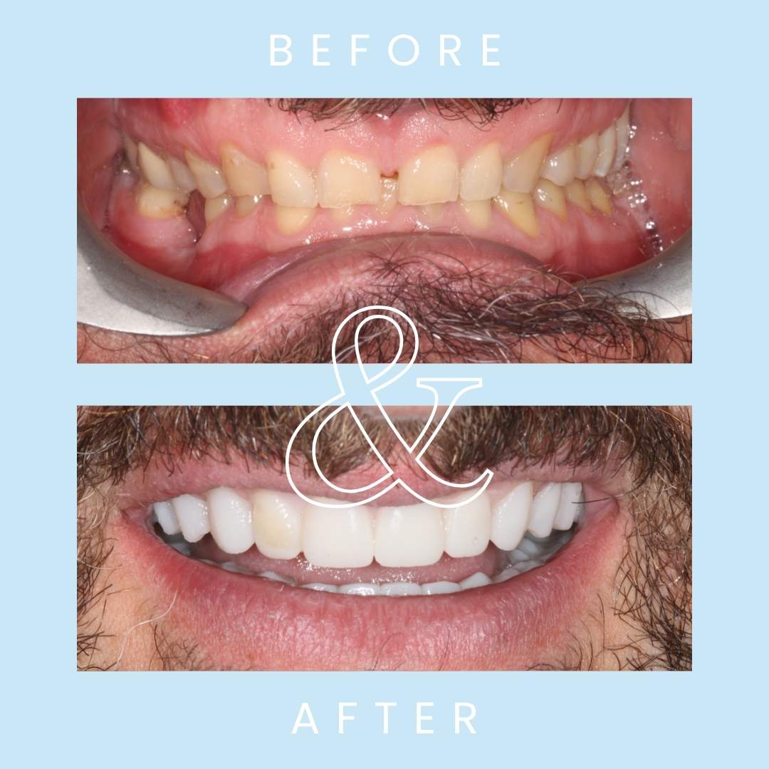 I Have Really Bad Teeth - What Are My Options?